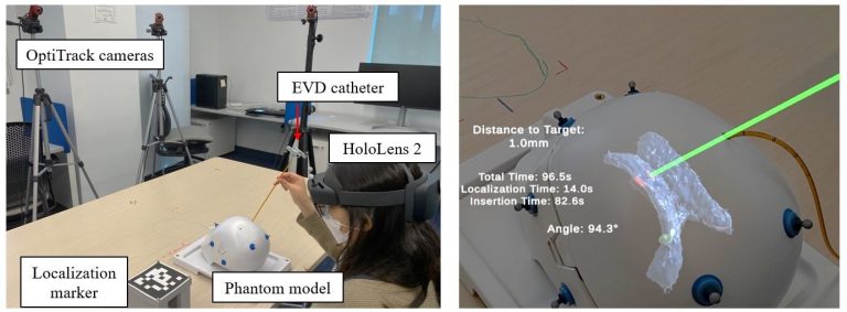 NeuroLens | Changing the world, one day at a time